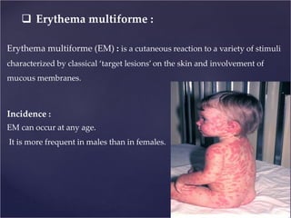 ERYTHEMA MULTIFORME.pptx