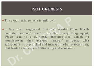 Erythema multiforme Dr Chithra P | PPT