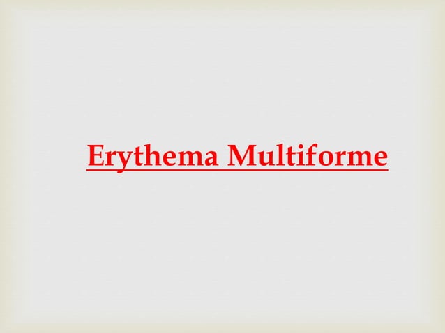Erythema multiforme, Steven-Johnson syndrome and Toxic Epidermal ...