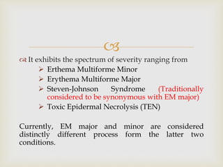 Erythema Multiforme Major Vs Minor