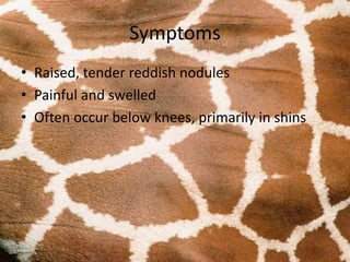 Erythema nodosum | PPTX