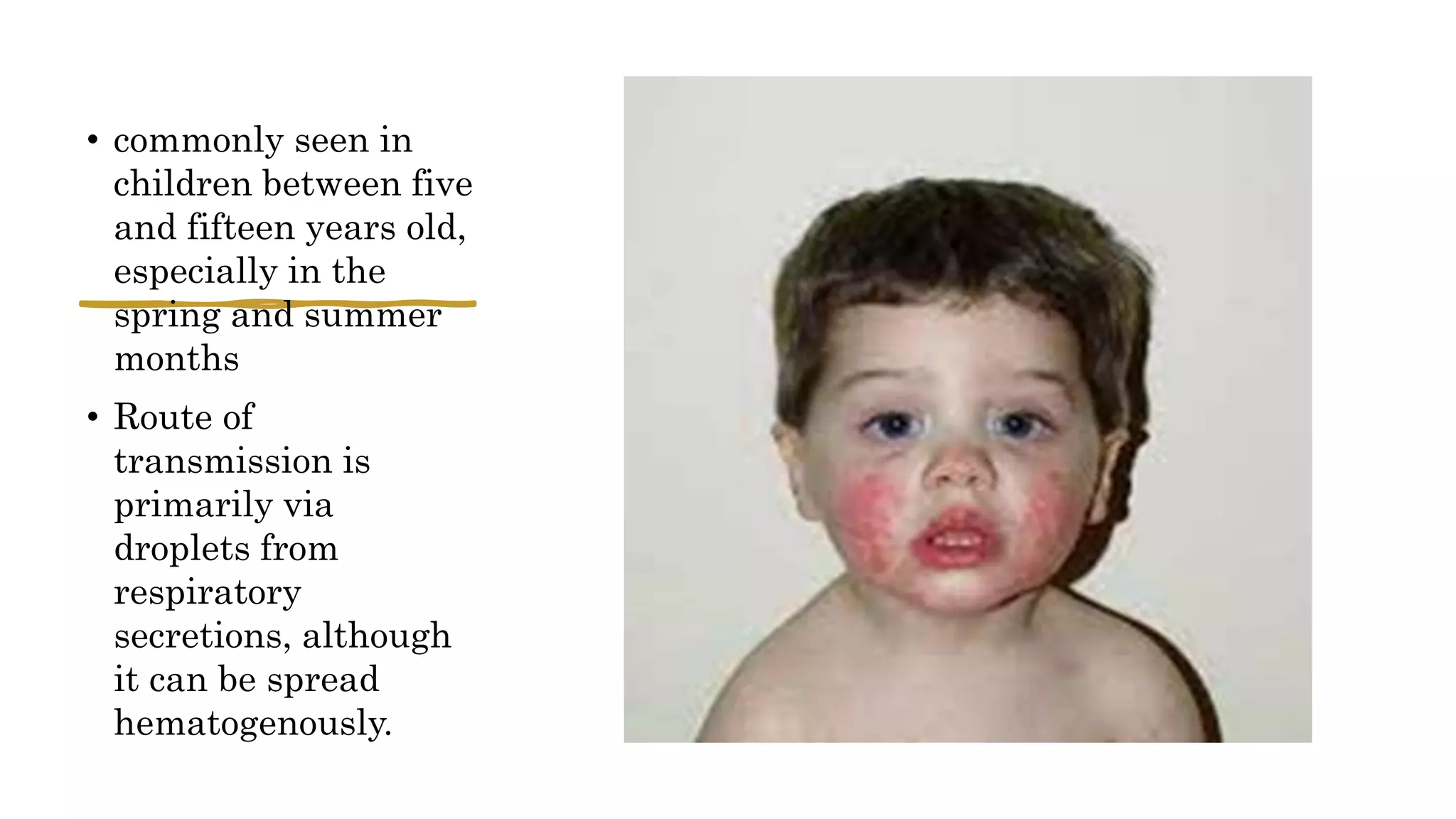 Erythema (redness of skin) | PPTX
