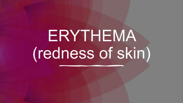 Erythema (redness of skin) | PPT