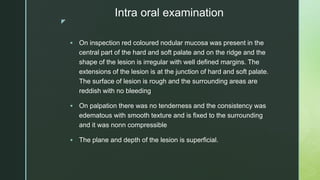 erythematous candidiasis new.pptx