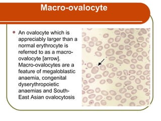 Ovalocyte