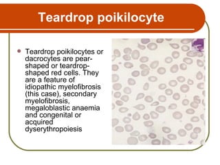 Teardrop Cells