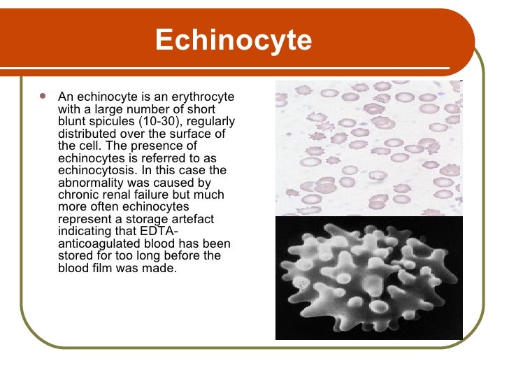 Erythocyte