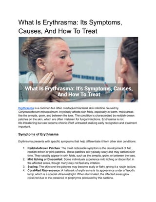 What Is Erythrasma: Its Symptoms, Causes, And How To Treat | PDF | Skin ...