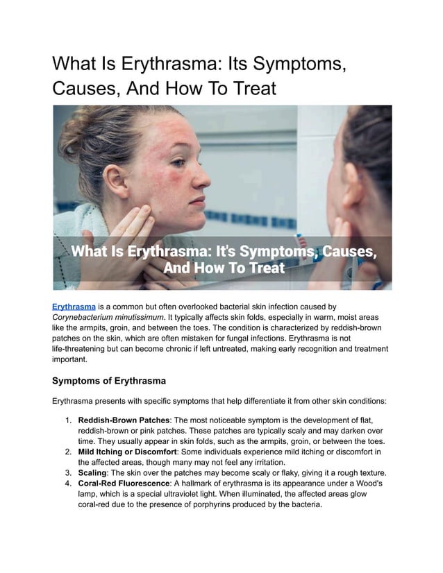 What Is Erythrasma: Its Symptoms, Causes, And How To Treat | PDF | Skin ...