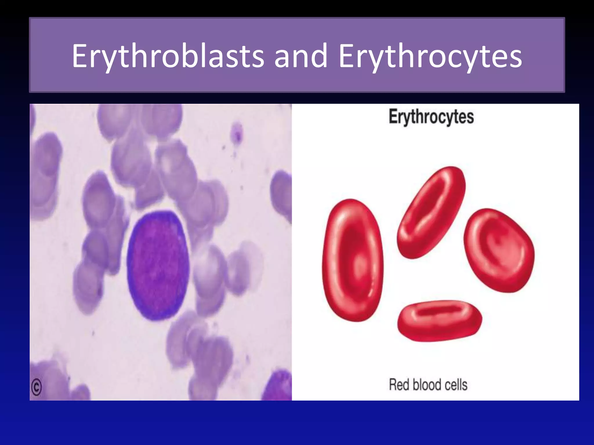 Erythroblastosis | PPTX