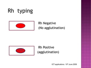 erythroblastosisfoetalis | PPTX