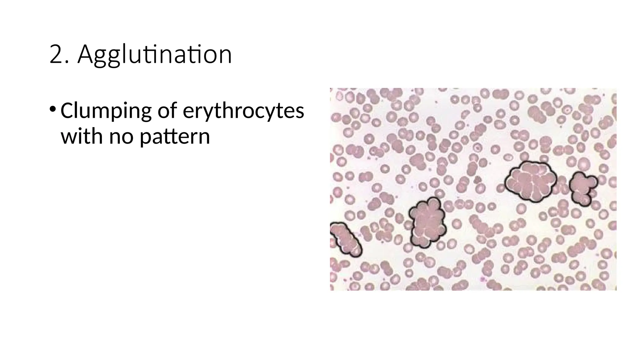 Erythrocyte-Morphology-and-Inclusions 2 (2).pptx