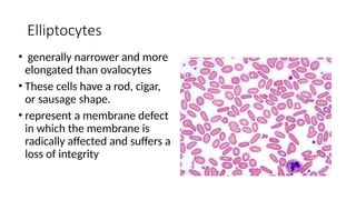 Erythrocyte-Morphology-and-Inclusions 2 (2).pptx
