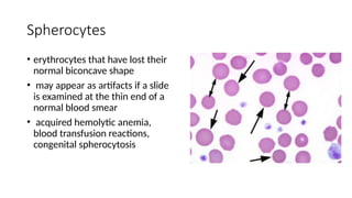 Erythrocyte-Morphology-and-Inclusions 2 (2).pptx