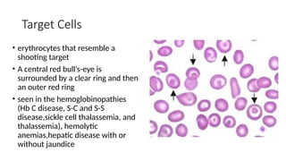 Erythrocyte-Morphology-and-Inclusions 2 (2).pptx