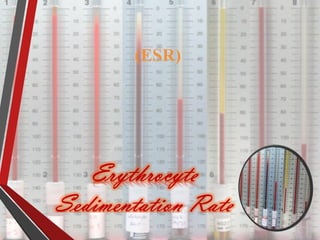 Hematology Erythrocyte-Sedimentation-Rate.ppt