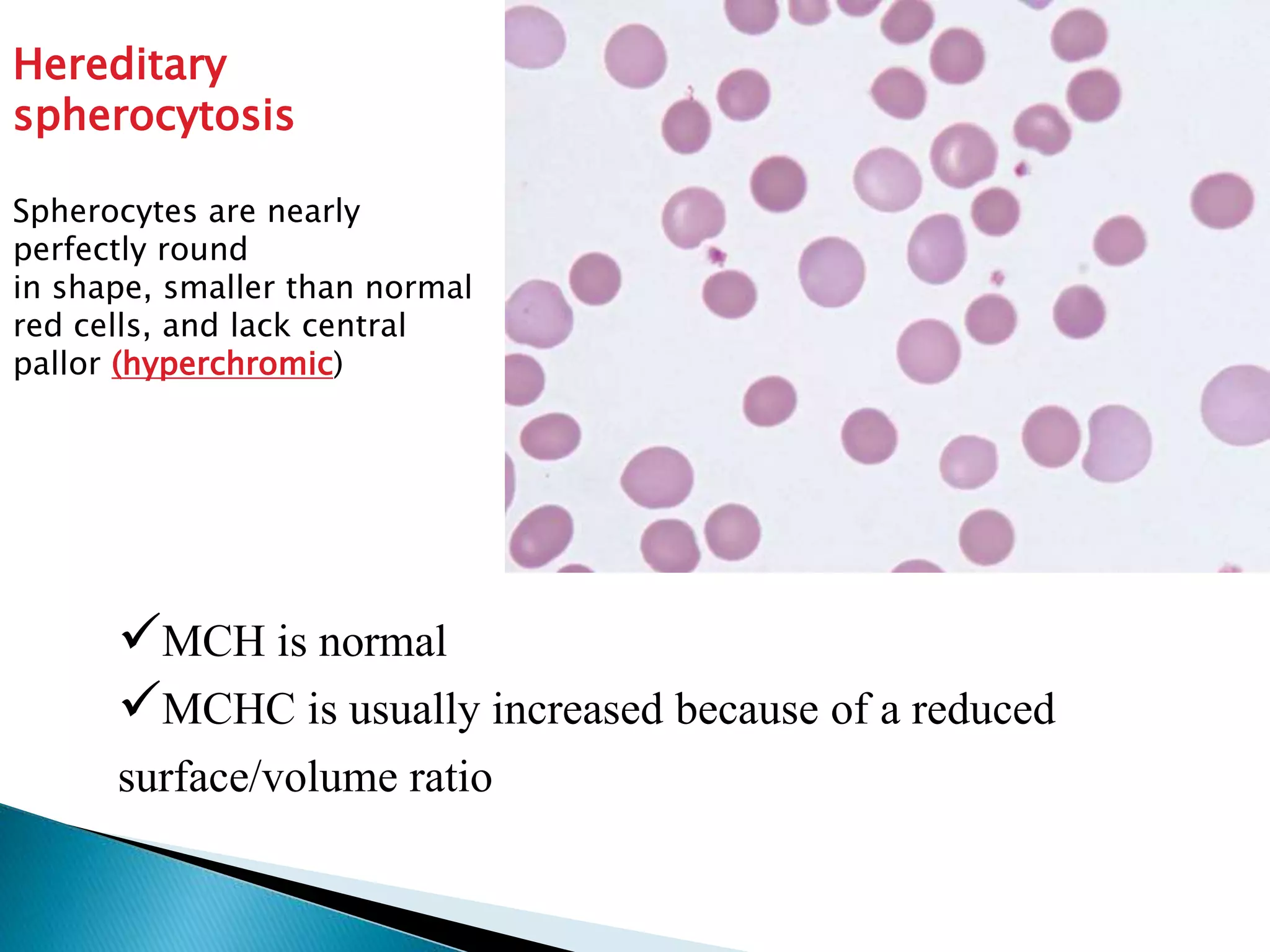 Erythrocyte indices | PPTX