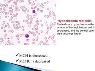 Erythrocyte indices | PPTX
