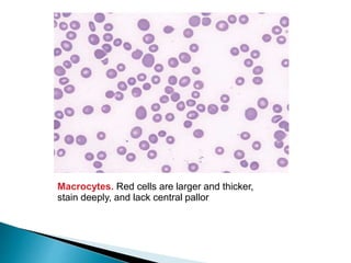 Erythrocyte indices | PPTX