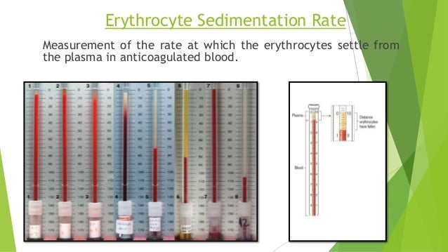 Erythrocyte sedimentation rate