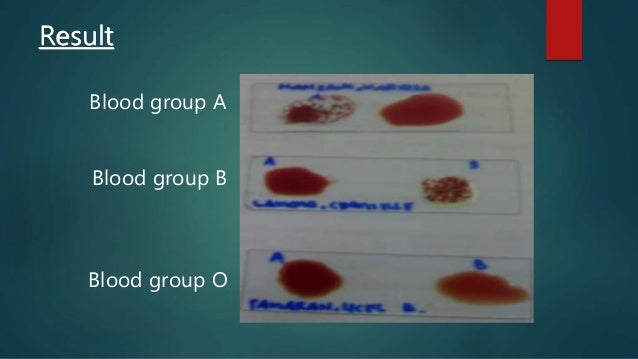 Erythrocyte sedimentation rate.and blood groups