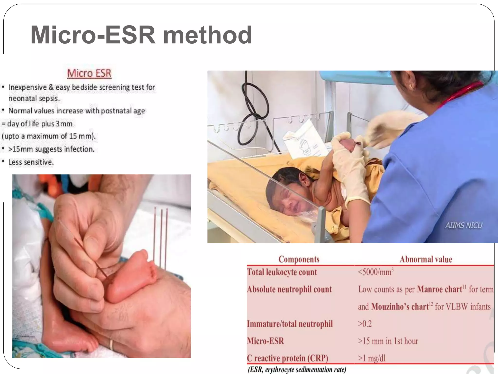 Erythrocyte sedimentation rate (ESR).pptx