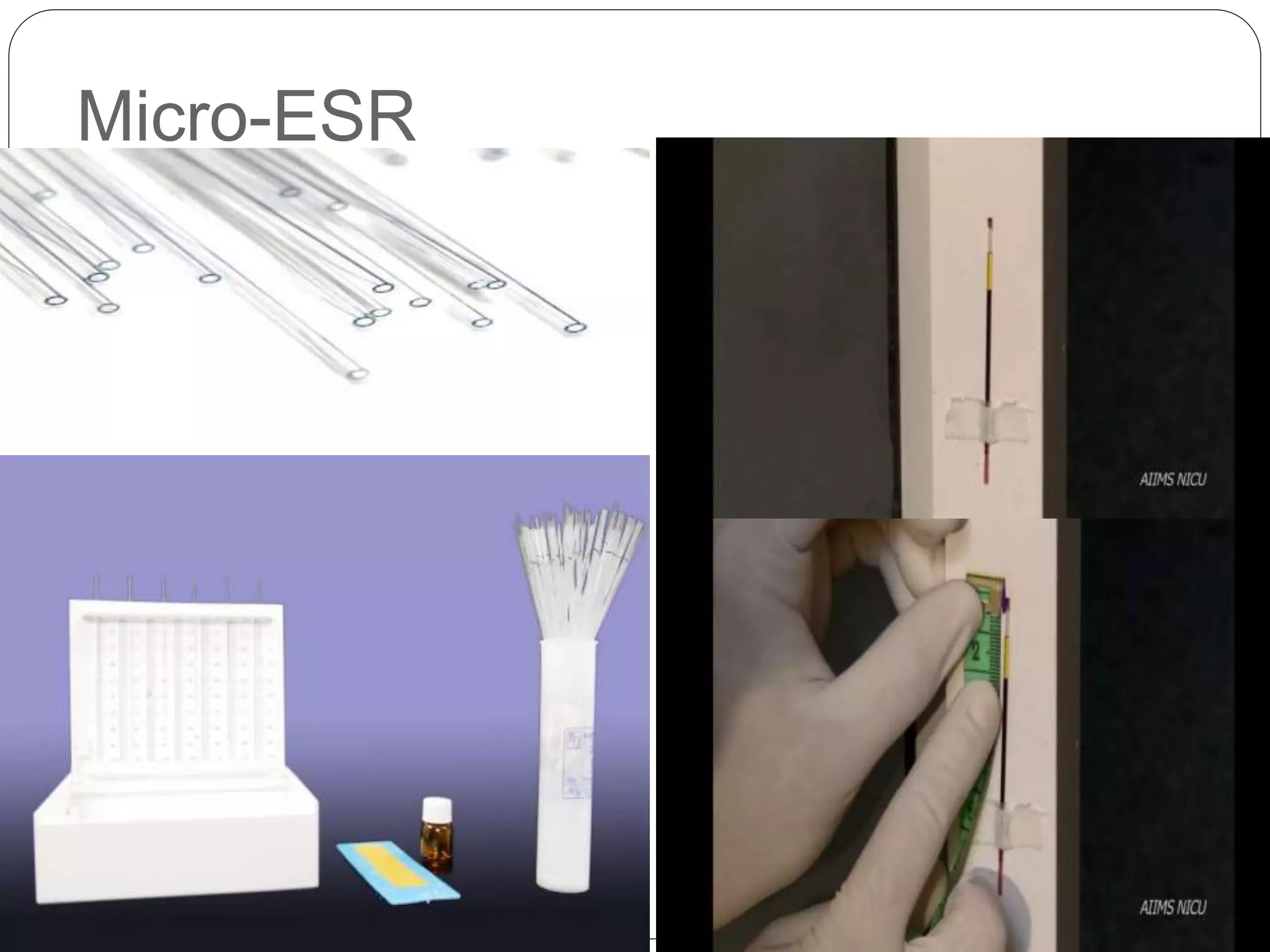 Erythrocyte sedimentation rate (ESR).pptx