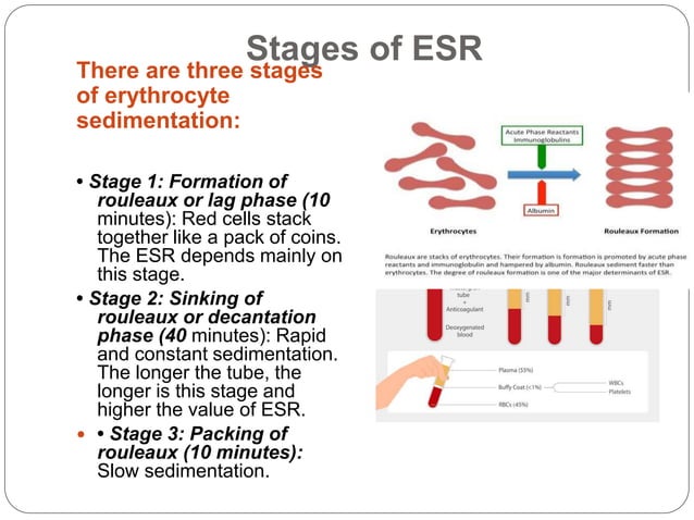 Erythrocyte sedimentation rate (ESR).pptx | Blood Disorders | Diseases and Conditions