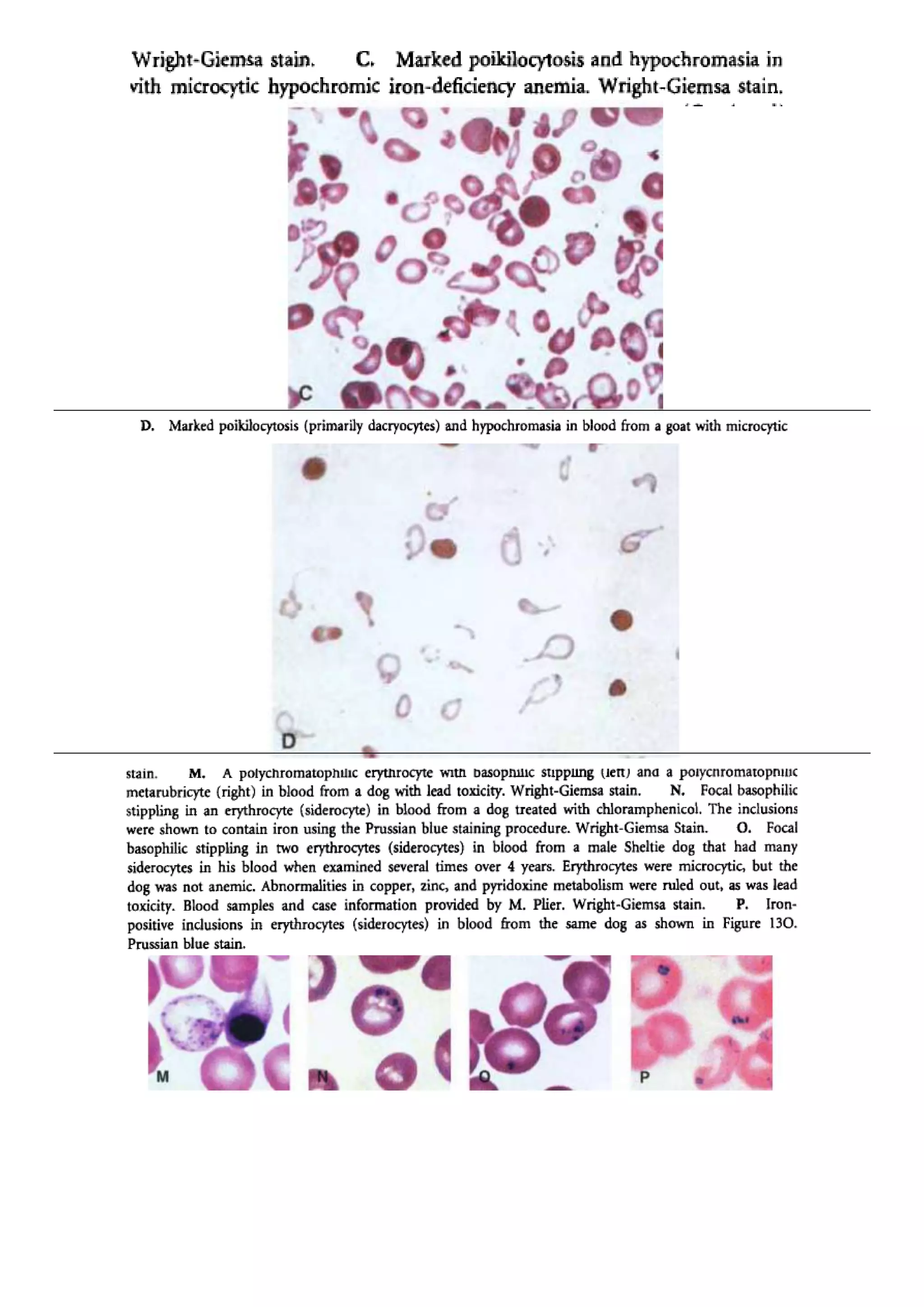 Erythrocyte series عملي دكتور عبد الامير ّجامعة الكوفة تشخيصات | PDF