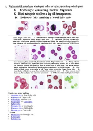 Erythrocyte series عملي دكتور عبد الامير ّجامعة الكوفة تشخيصات | PDF