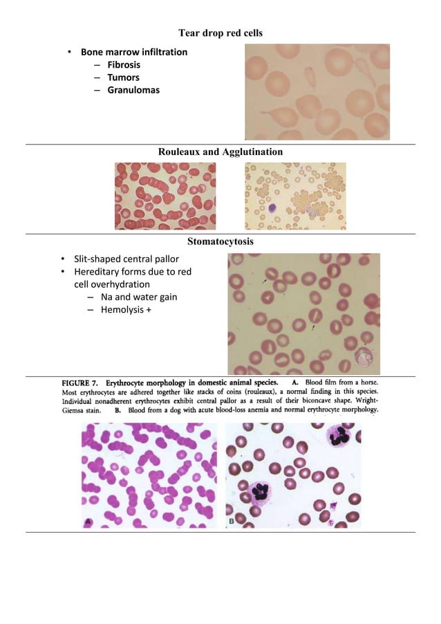 Erythrocyte series عملي دكتور عبد الامير ّجامعة الكوفة تشخيصات | PDF