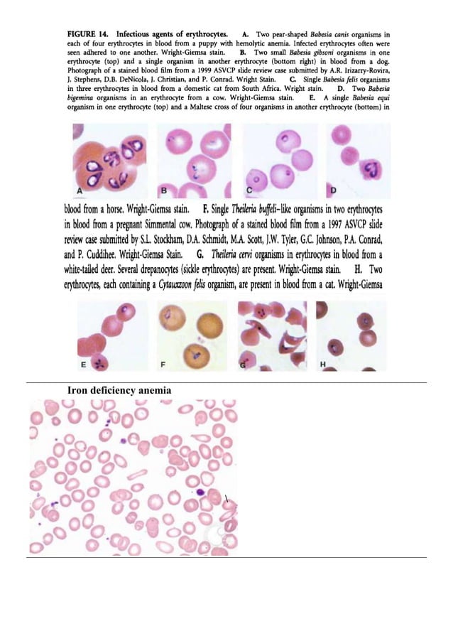 Erythrocyte series عملي دكتور عبد الامير ّجامعة الكوفة تشخيصات | PDF