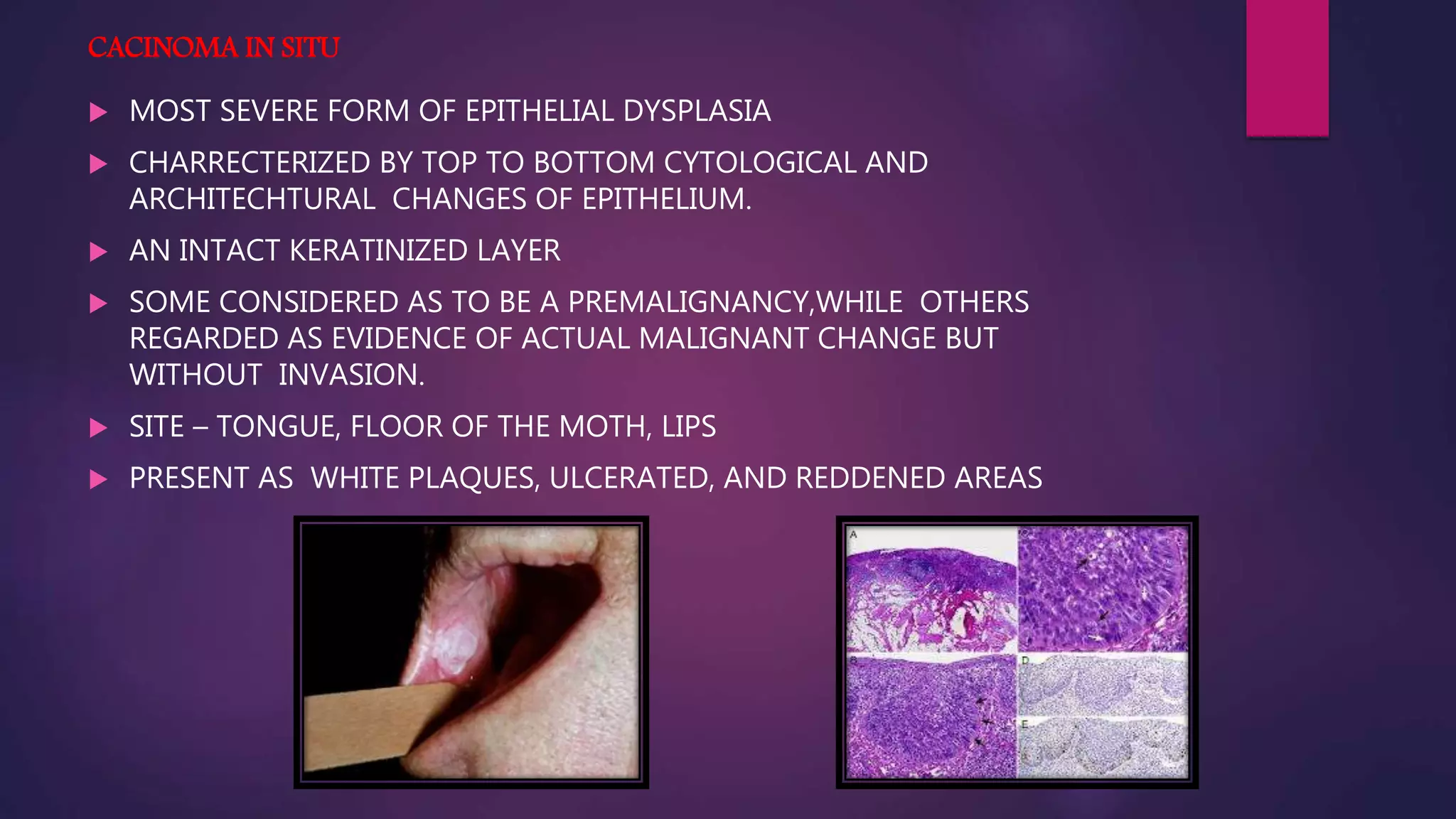 Erythroplakia | PPTX