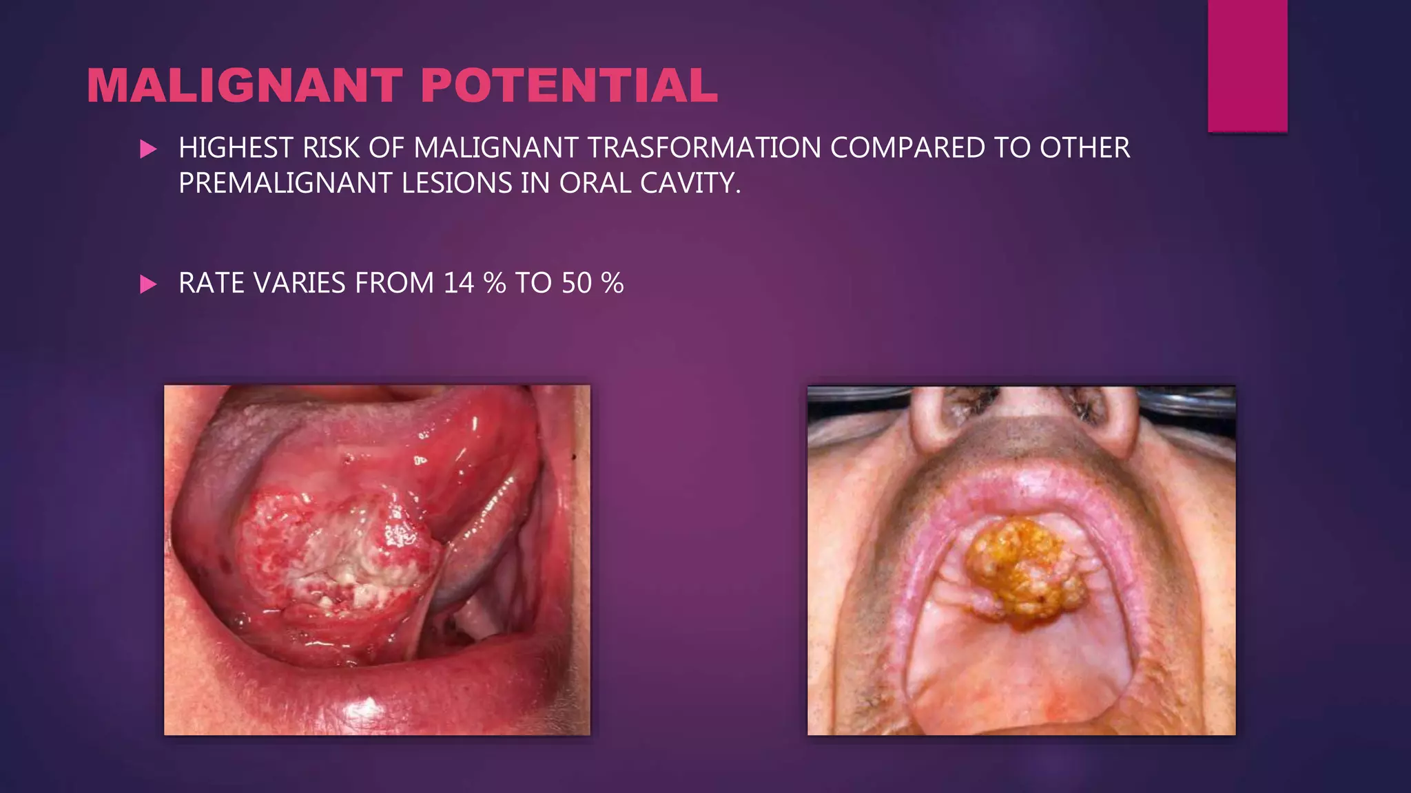 Erythroplakia | PPTX