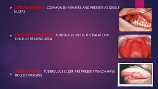 Erythroplakia | PPTX