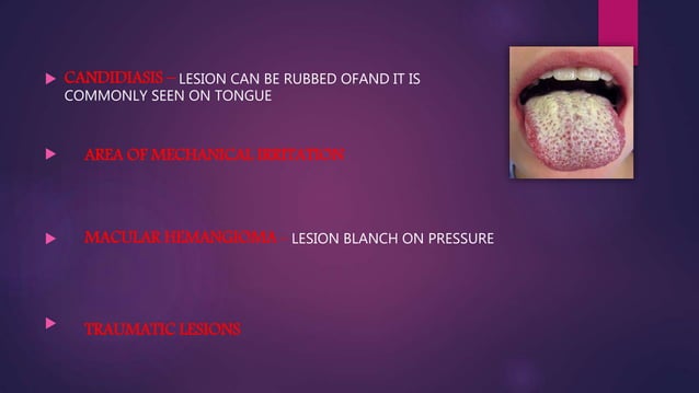 Erythroplakia | PPTX | Dental Health | Diseases and Conditions