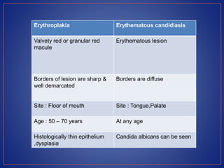 Erythroplakia - | PPTX