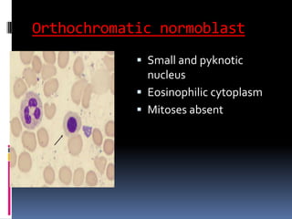 Orthochromatic Normoblast