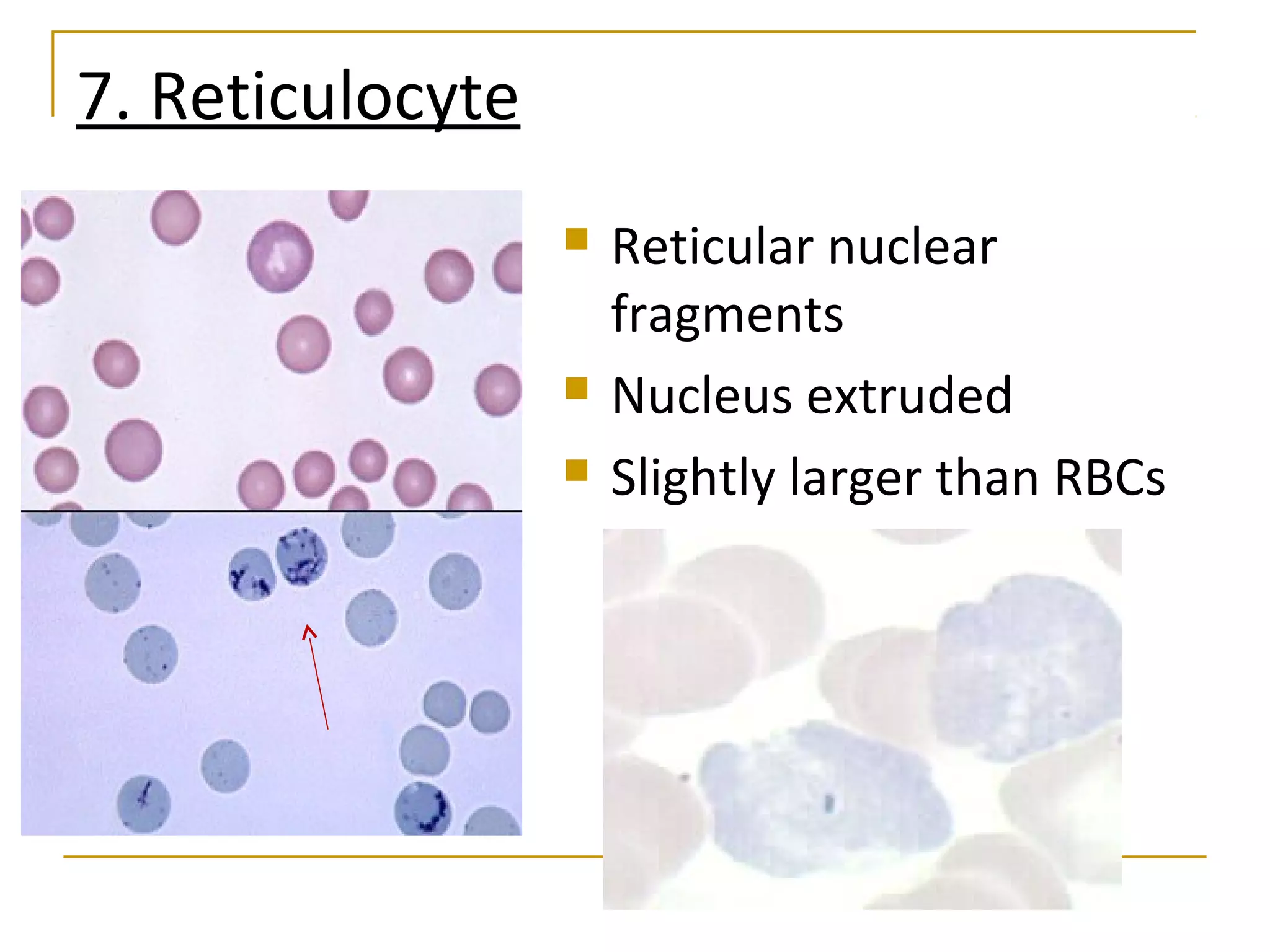 Erythropoiesis | PPT