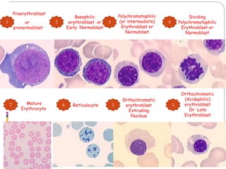 Polychromatophilic Erythroblast