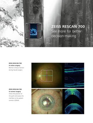 Zeiss opmi-lumera700 rescan 700 microscope | PDF | Eye and Vision ...