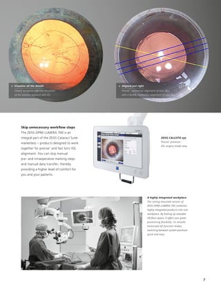 Zeiss opmi-lumera700 rescan 700 microscope | PDF | Eye and Vision ...