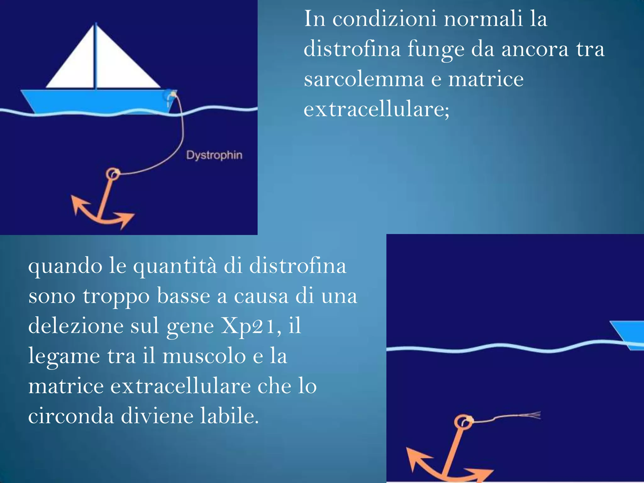 La Distrofia Muscolare di Duchenne | PPTX