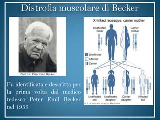 La Distrofia Muscolare di Duchenne | PPTX