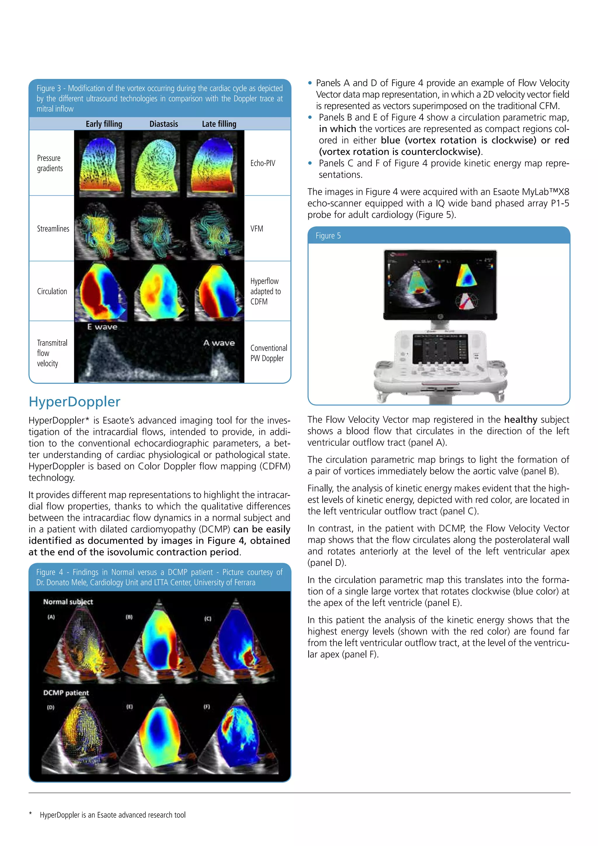 HyperDoppler, Esaote | PDF