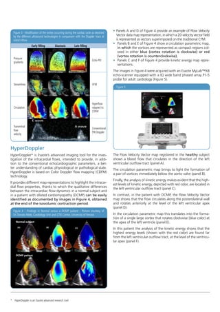 HyperDoppler, Esaote | PDF