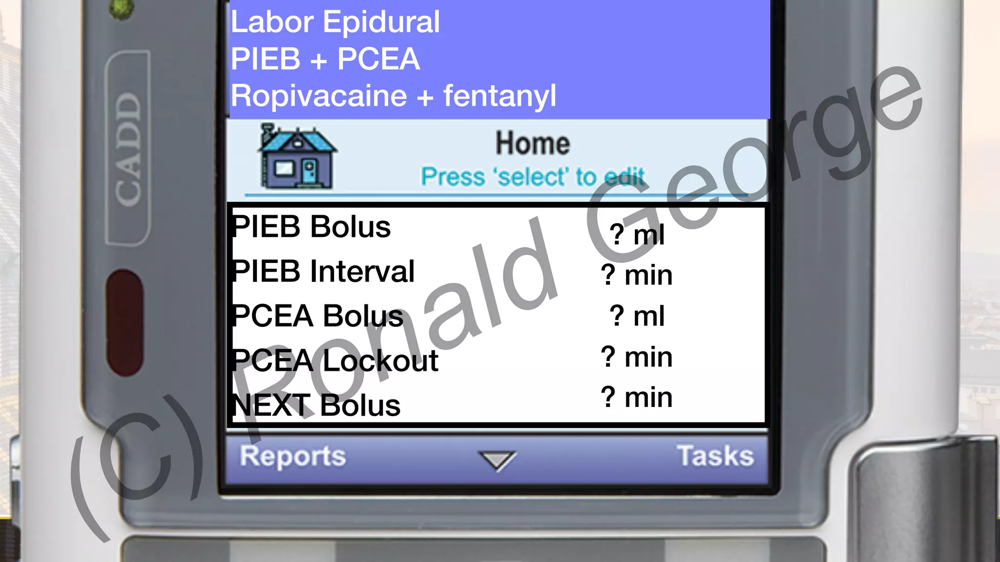 EuroAnaesthesia 2019 - PIEB Labour Analgesia | PPT