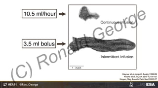 EuroAnaesthesia 2019 - PIEB Labour Analgesia | PDF