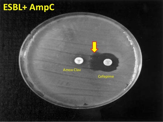 Esbl Keyhole Effect Laser And Material Interaction: The Keyhole Effect