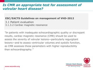 Assessment of Aortic Regurgitation with Cardiovascular Magnetic ...